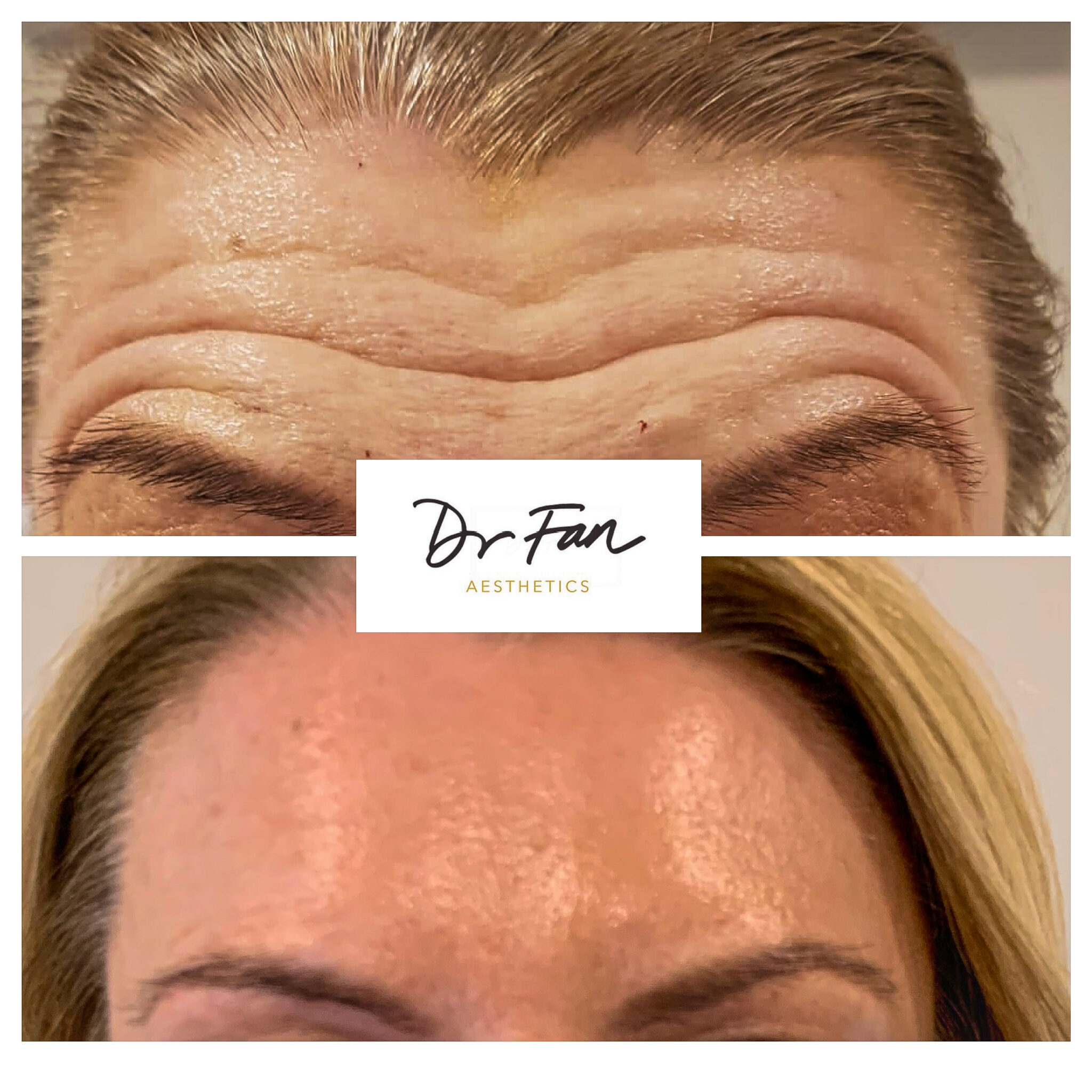 Gallery - Dr Fan Aesthetics