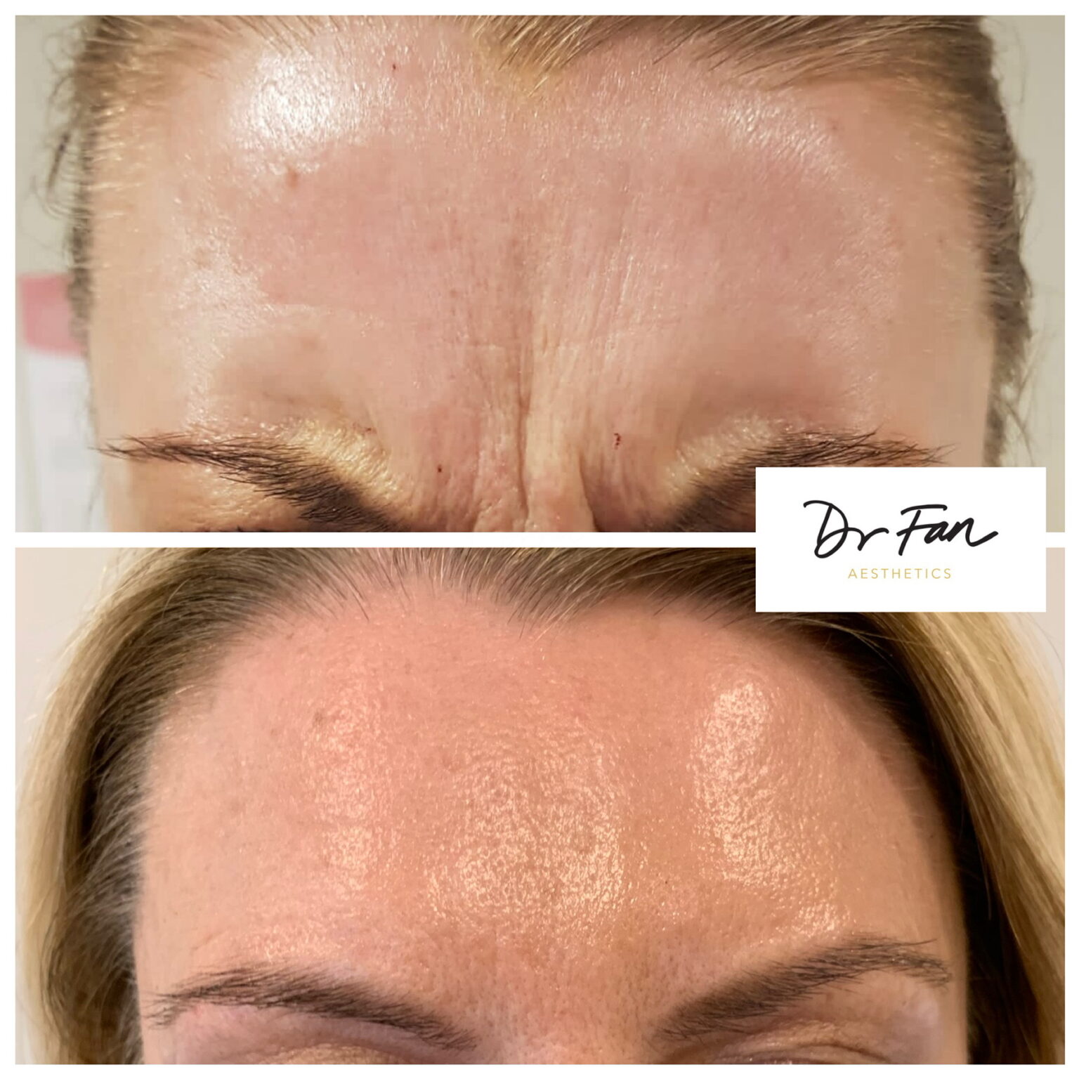 Gallery - Dr Fan Aesthetics