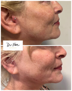 Gallery - Dr Fan Aesthetics