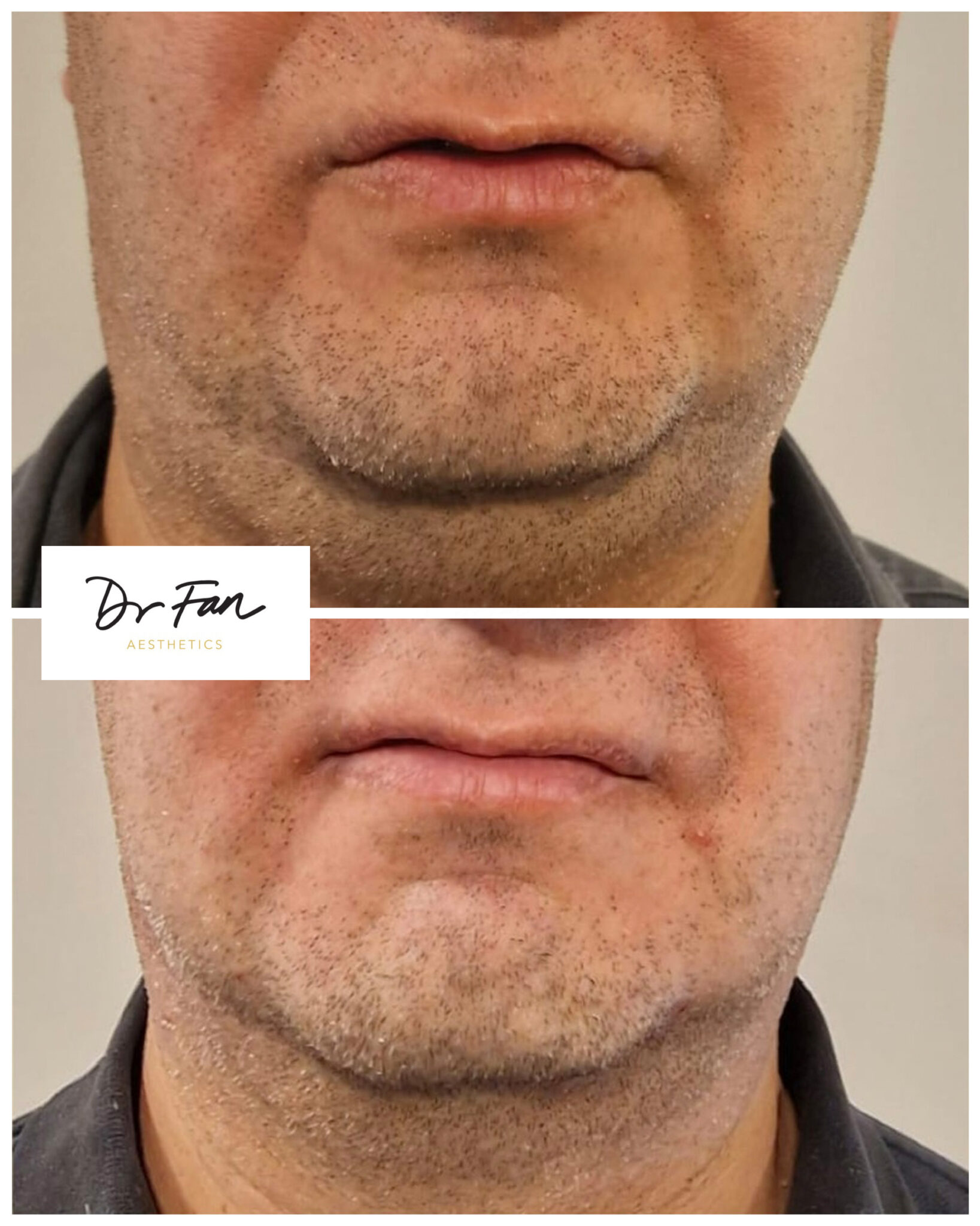 Gallery - Dr Fan Aesthetics
